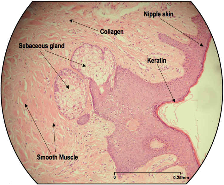 HistoQuarterly: BREAST | Histology Blog