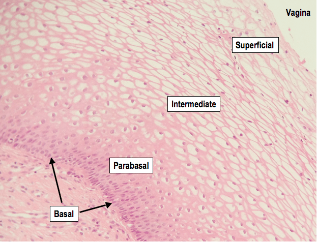 HistoQuarterly: CERVIX | Histology Blog