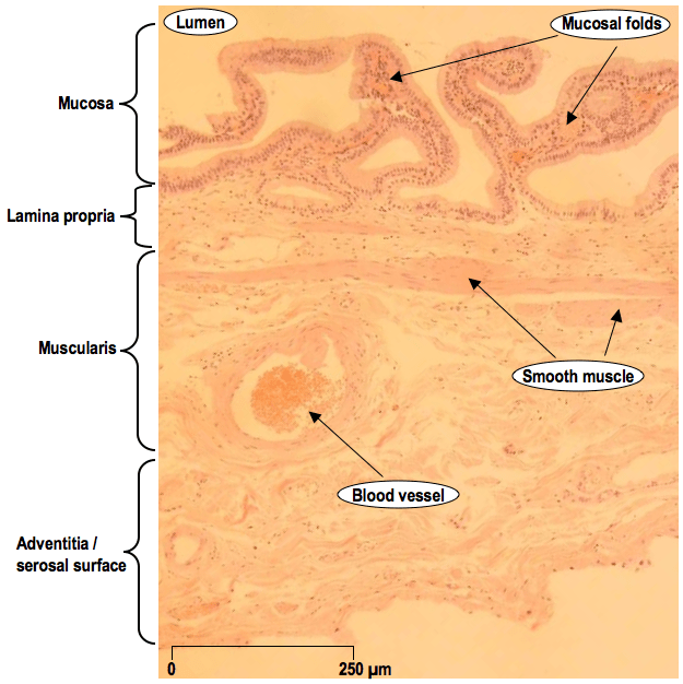 HistoQuarterly: GALLBLADDER | Histology Blog