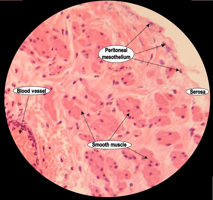 HistoQuarterly: FALLOPIAN TUBE | Histology Blog