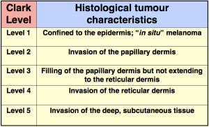 HistoQuarterly: SUPERFICIAL SPREADING MALIGNANT MELANOMA | Histology Blog