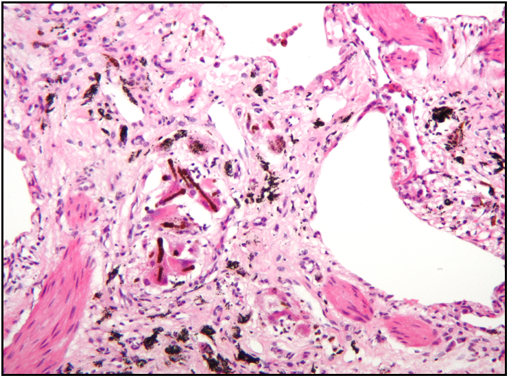 HistoQuarterly: THE TISSUE TEST | Histology Blog