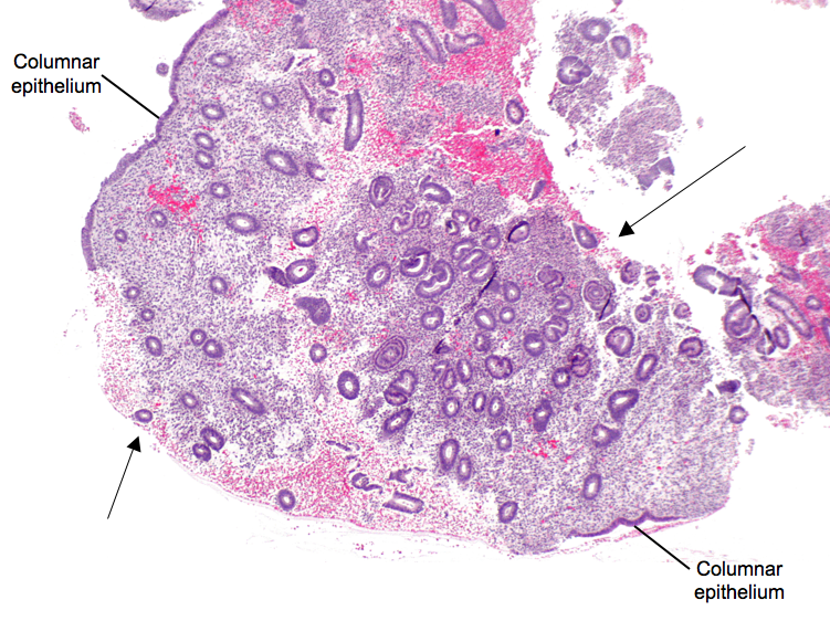HistoQuarterly: ENDOMETRIUM | Histology Blog